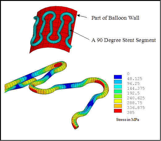 Stress Analysis of a Cardiovascular Stent